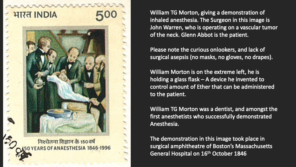 A curious case of the "missing" anaesthetist